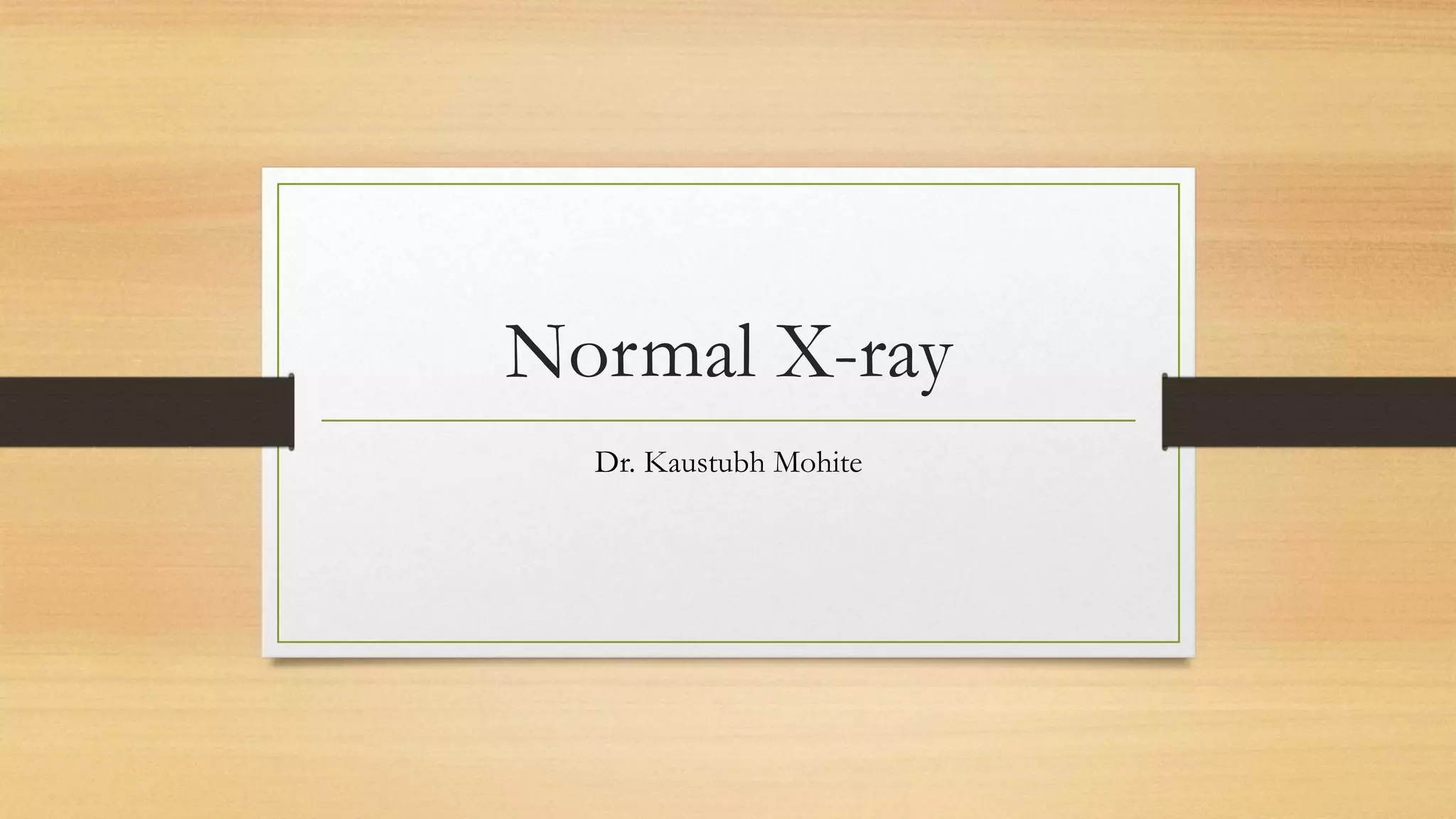 Normal chest x ray | PPTX