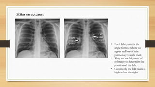 Normal chest x ray | PPTX