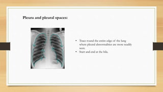 Normal chest x ray | PPTX