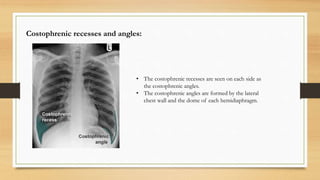 Normal chest x ray | PPTX