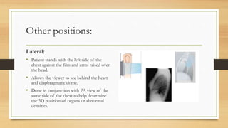 Normal chest x ray | PPTX
