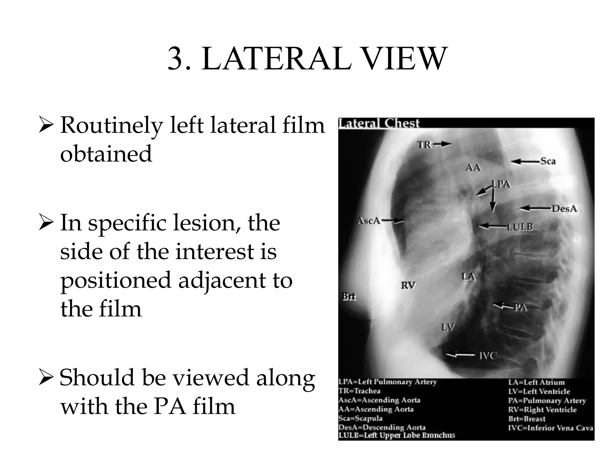 Normal Chest X-Rays & Its Systemic Approach- Anatomy | PPTX