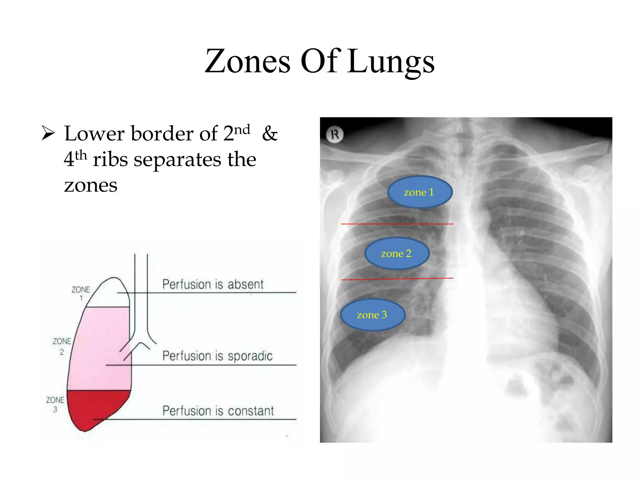Normal Chest X-Rays & Its Systemic Approach- Anatomy | PPTX