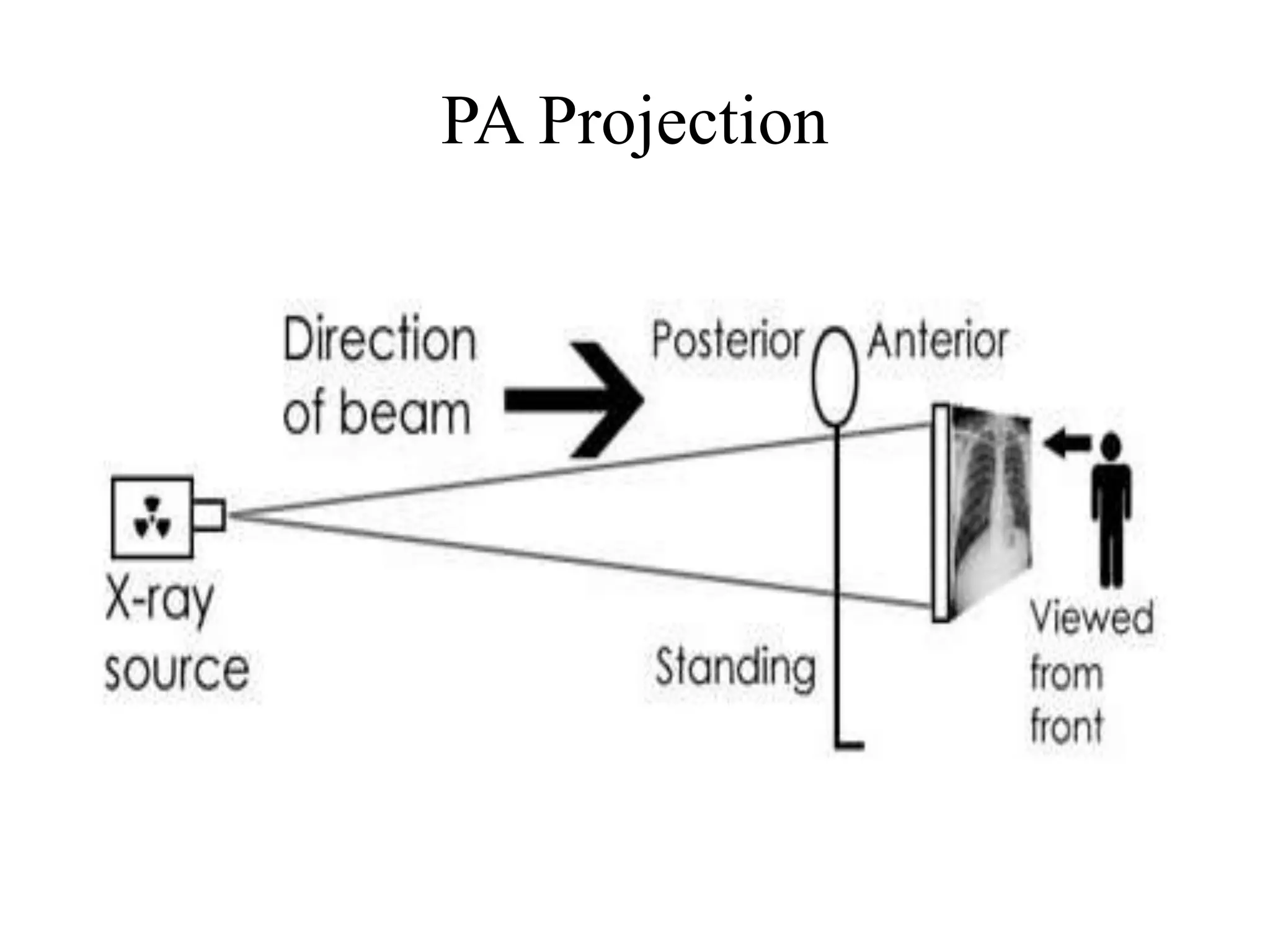 Normal Chest X-Rays & Its Systemic Approach- Anatomy | PPTX
