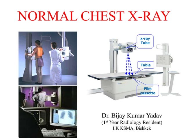 Normal Chest X-Rays & Its Systemic Approach- Anatomy | PPTX