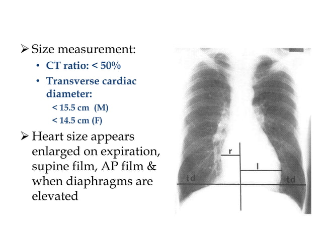 Normal Chest X-Rays & Its Systemic Approach- Anatomy | PPTX