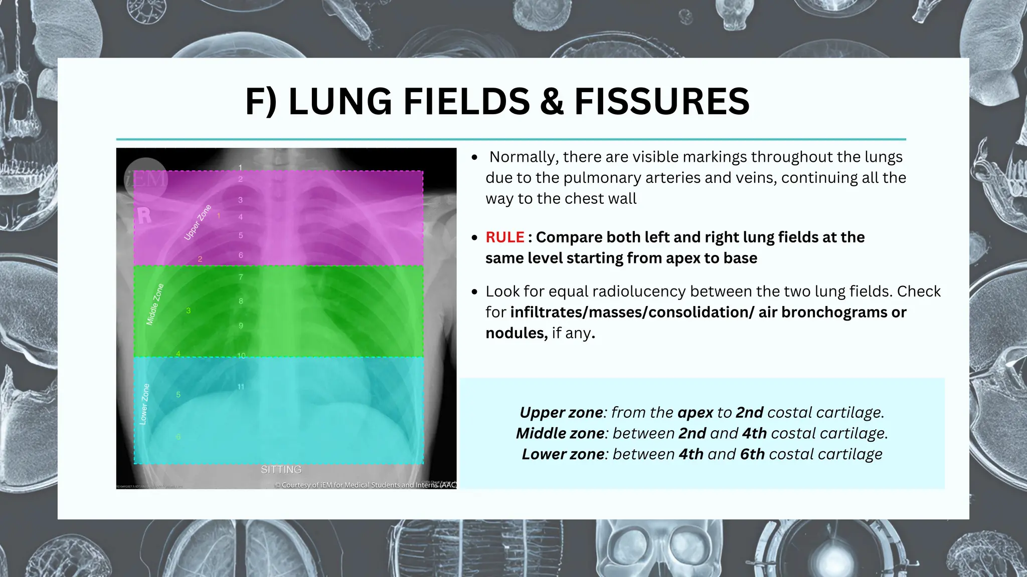 Normal chest Xray: Fundamentals and Basic Interpretation (By Dr ...