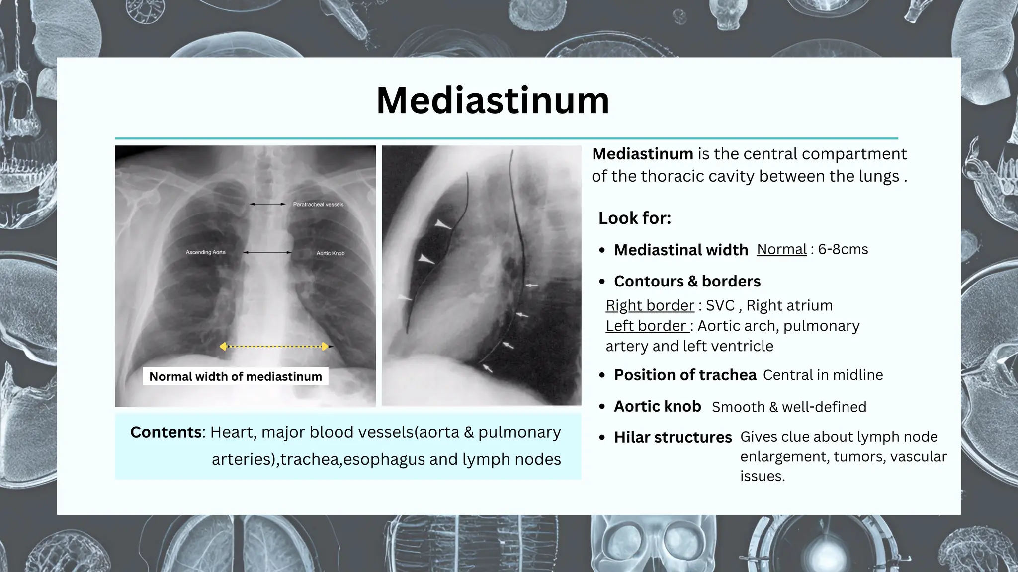 Normal chest Xray: Fundamentals and Basic Interpretation (By Dr ...