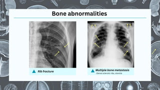 Normal chest Xray: Fundamentals and Basic Interpretation (By Dr ...