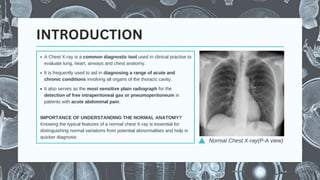 Normal chest Xray: Fundamentals and Basic Interpretation (By Dr ...