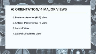 Normal chest Xray: Fundamentals and Basic Interpretation (By Dr ...