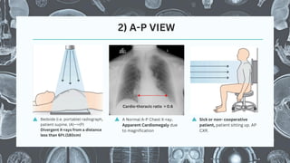 Normal chest Xray: Fundamentals and Basic Interpretation (By Dr ...