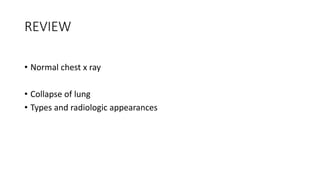 Normal chest x ray and collapse | PPTX