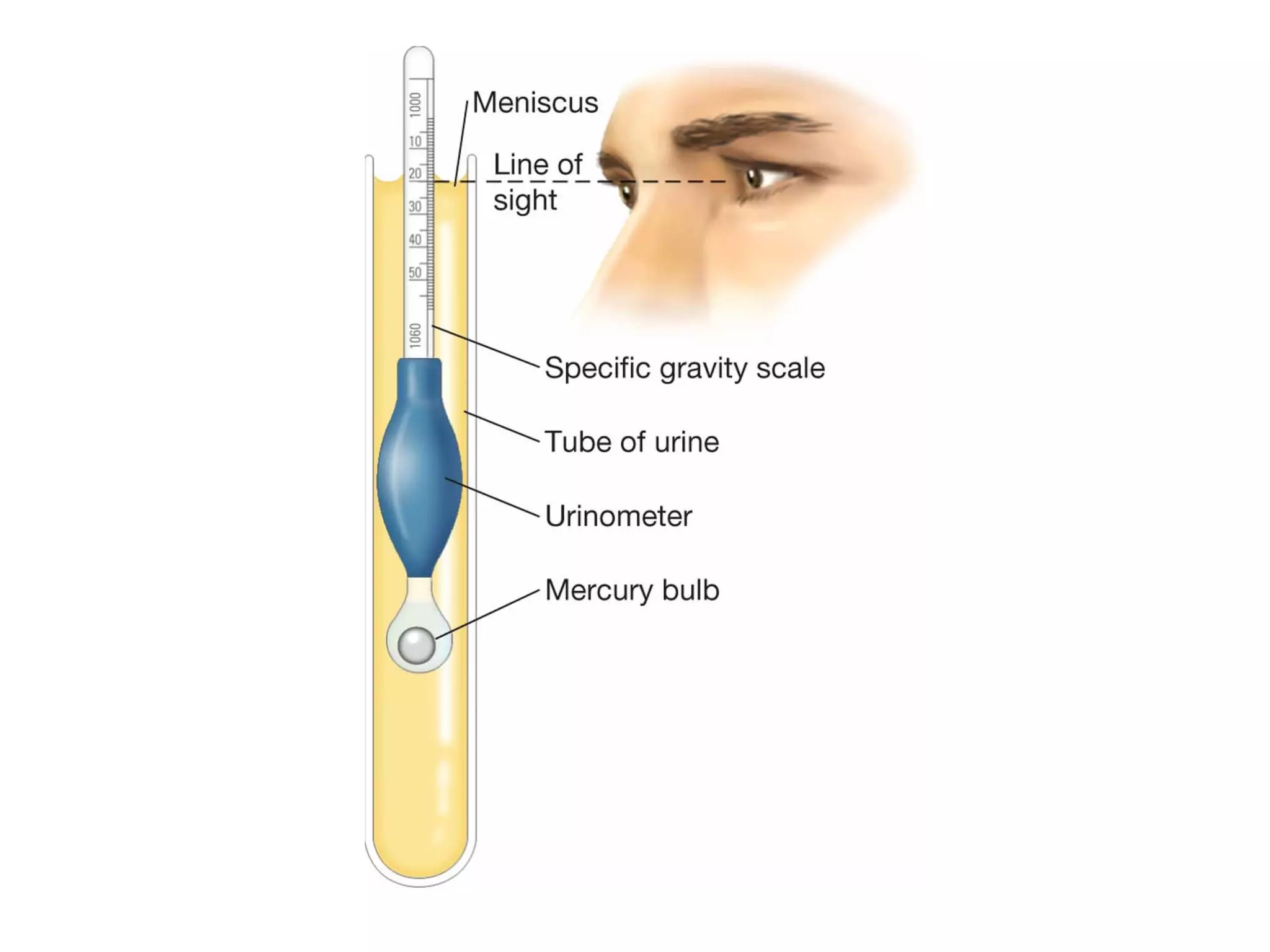 Normal constituents of urine | PPT