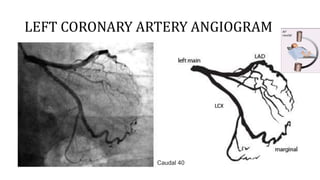 NORMAL CORONARY ANATOMY AND ANGIOGRAPHIC VIEWS SOURCE.pptx