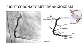 NORMAL CORONARY ANATOMY AND ANGIOGRAPHIC VIEWS SOURCE.pptx