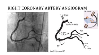 NORMAL CORONARY ANATOMY AND ANGIOGRAPHIC VIEWS SOURCE.pptx