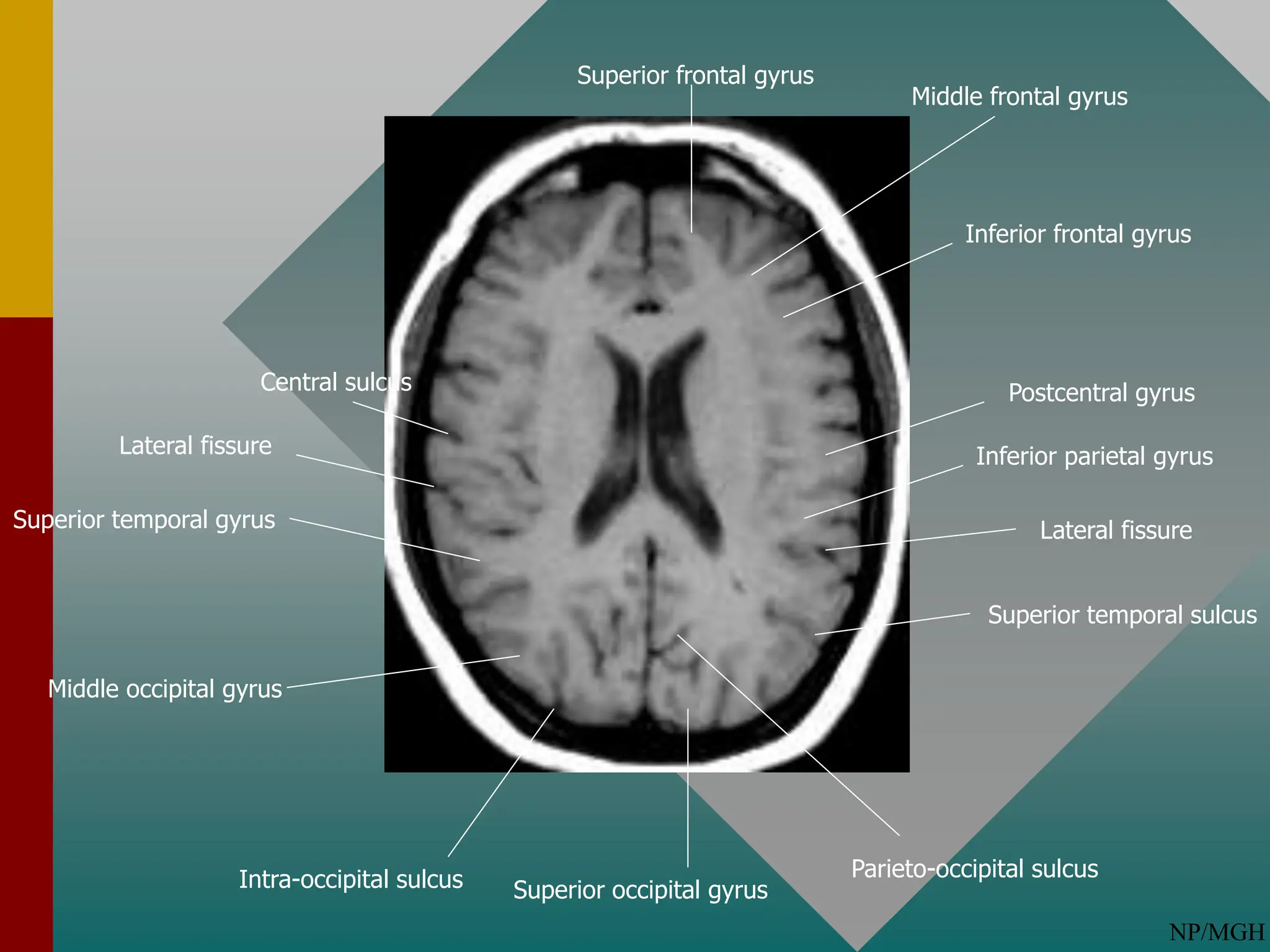 Normal Cortical Anatomy.pptx