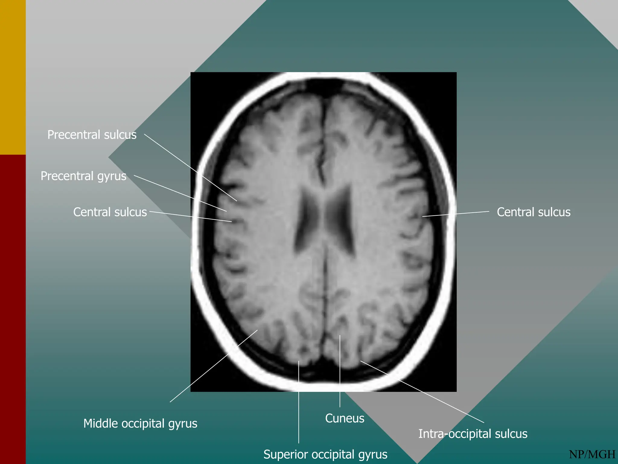 Normal Cortical Anatomy.pptx