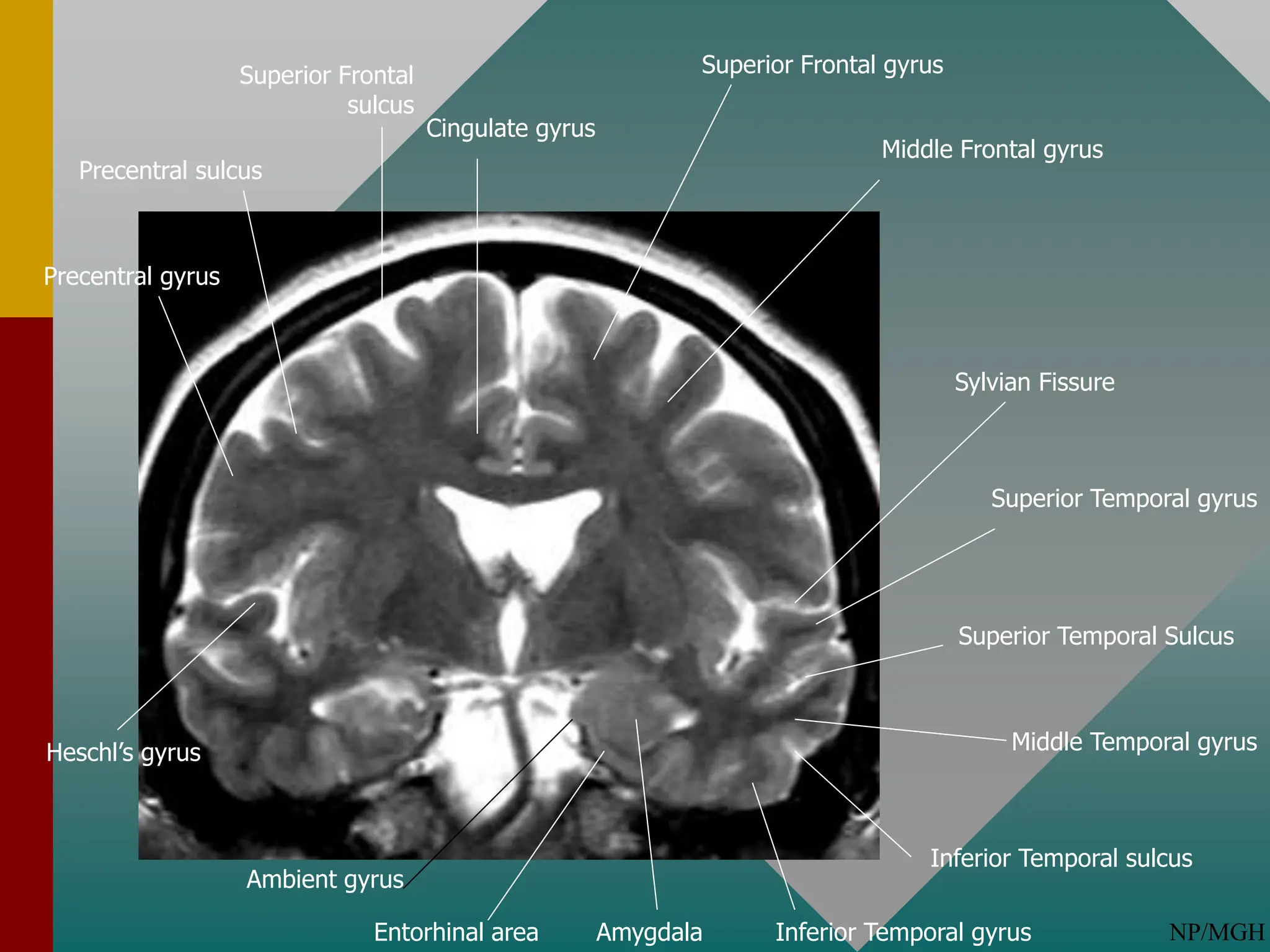 Normal Cortical Anatomy.pptx