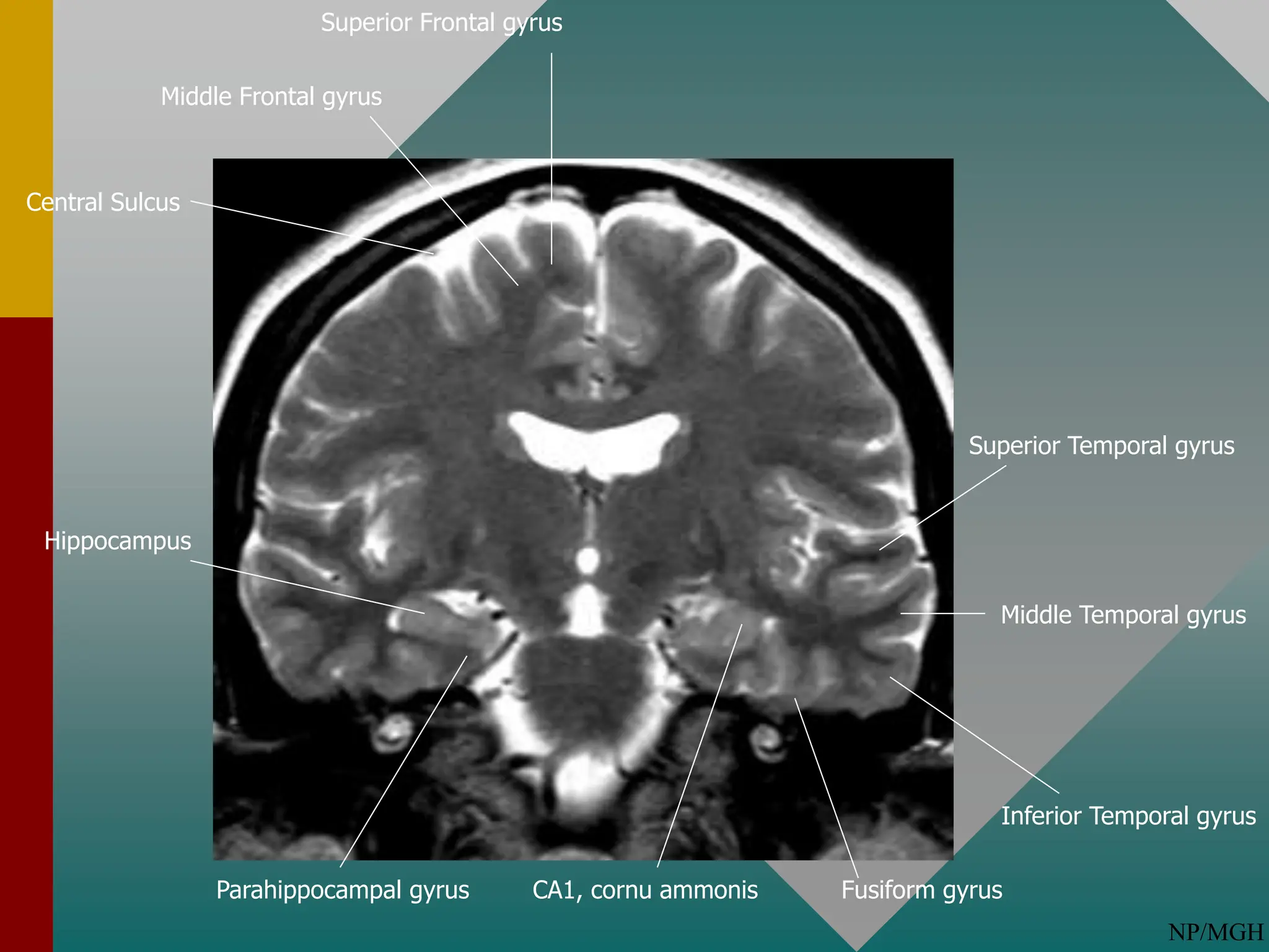Normal Cortical Anatomy.pptx