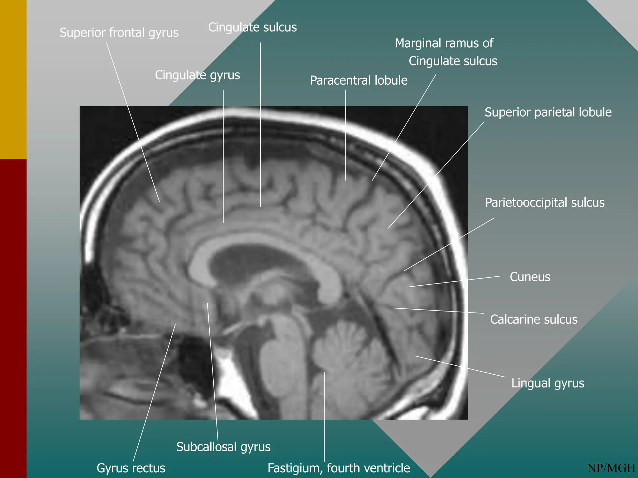 Normal Cortical Anatomy.pptx
