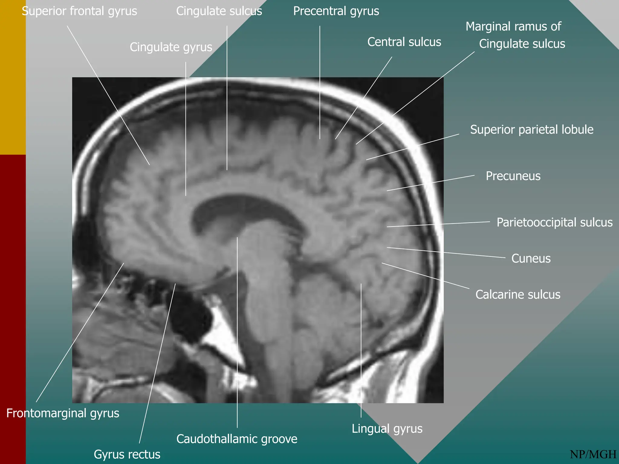 Normal Cortical Anatomy.pptx