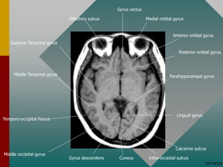 Normal Cortical Anatomy.pptx