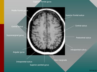 Normal Cortical Anatomy.pptx