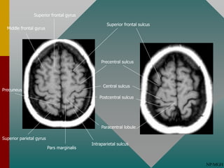 Normal Cortical Anatomy.pptx
