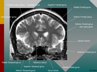 Normal Cortical Anatomy.pptx