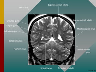 Normal Cortical Anatomy.pptx