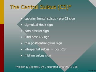 Normal Cortical Anatomy.pptx