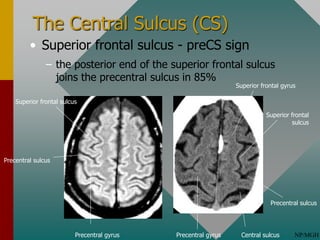 Normal Cortical Anatomy.pptx