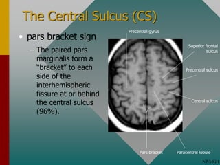 Normal Cortical Anatomy.pptx