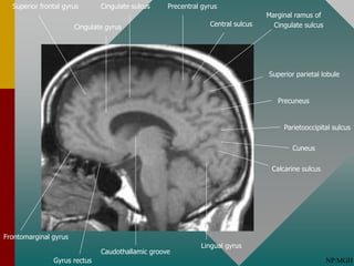 Normal Cortical Anatomy.pptx