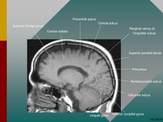 Normal Cortical Anatomy.pptx