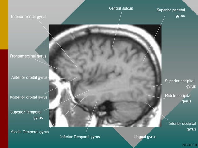Normal Cortical Anatomy.pptx