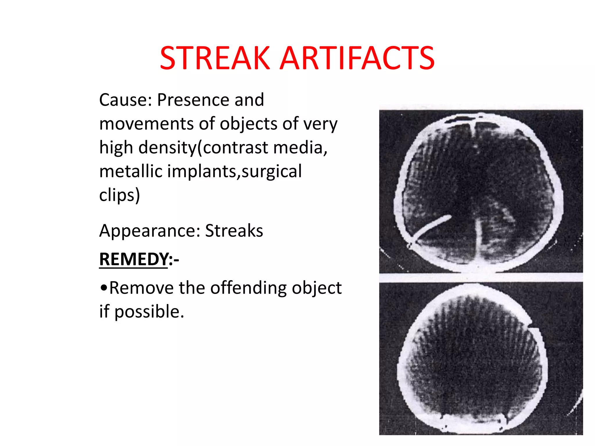 Normal CT BRAIN | PPTX