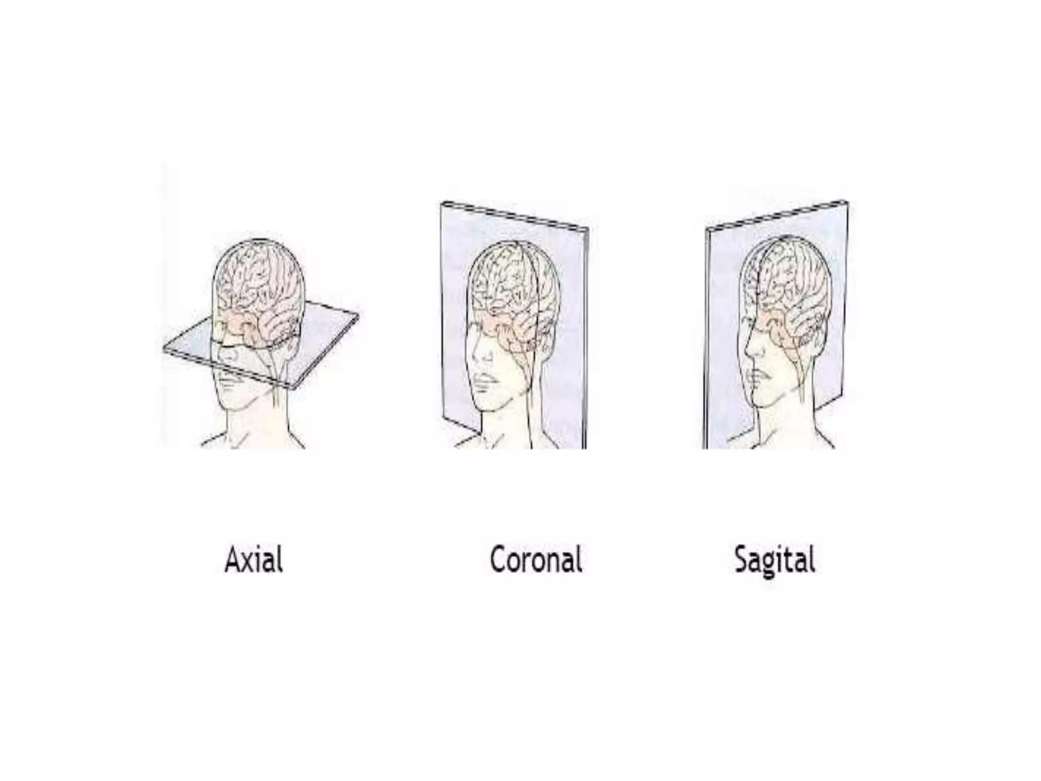 Normal CT BRAIN | PPTX