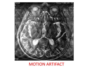 Normal CT BRAIN | PPTX