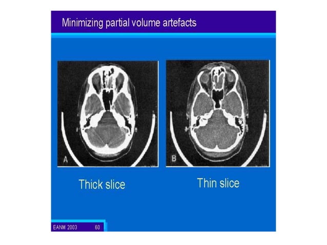 Normal CT BRAIN | PPTX | Brain and Nervous System Disorders | Diseases ...