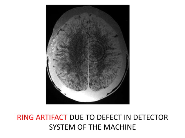 Normal CT BRAIN | PPTX | Brain and Nervous System Disorders | Diseases ...