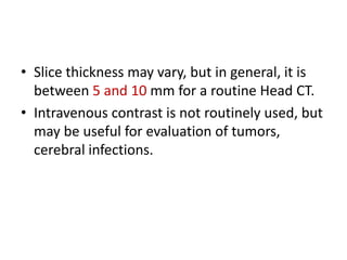 Normal CT BRAIN | PPTX