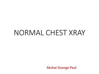 Normal cxr agp | PPT