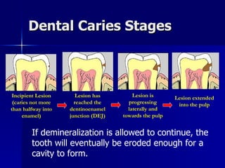 Normal+dental+development+and+oral+pathology | PPT
