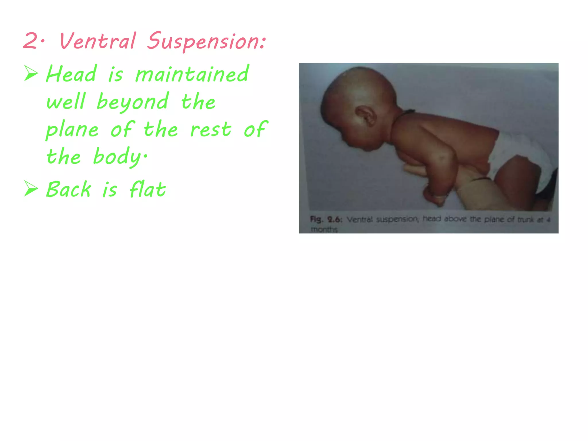 NORMAL DEVELOPMENTAL MILESTONES TILL 1 YEAR | PPT