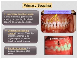 Normal development of occlusion part 1 | PPTX