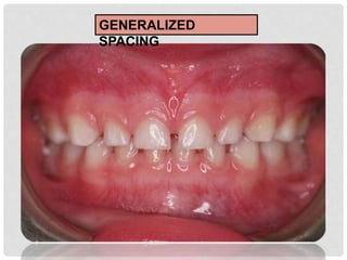 Normal development of occlusion part 1 | PPTX
