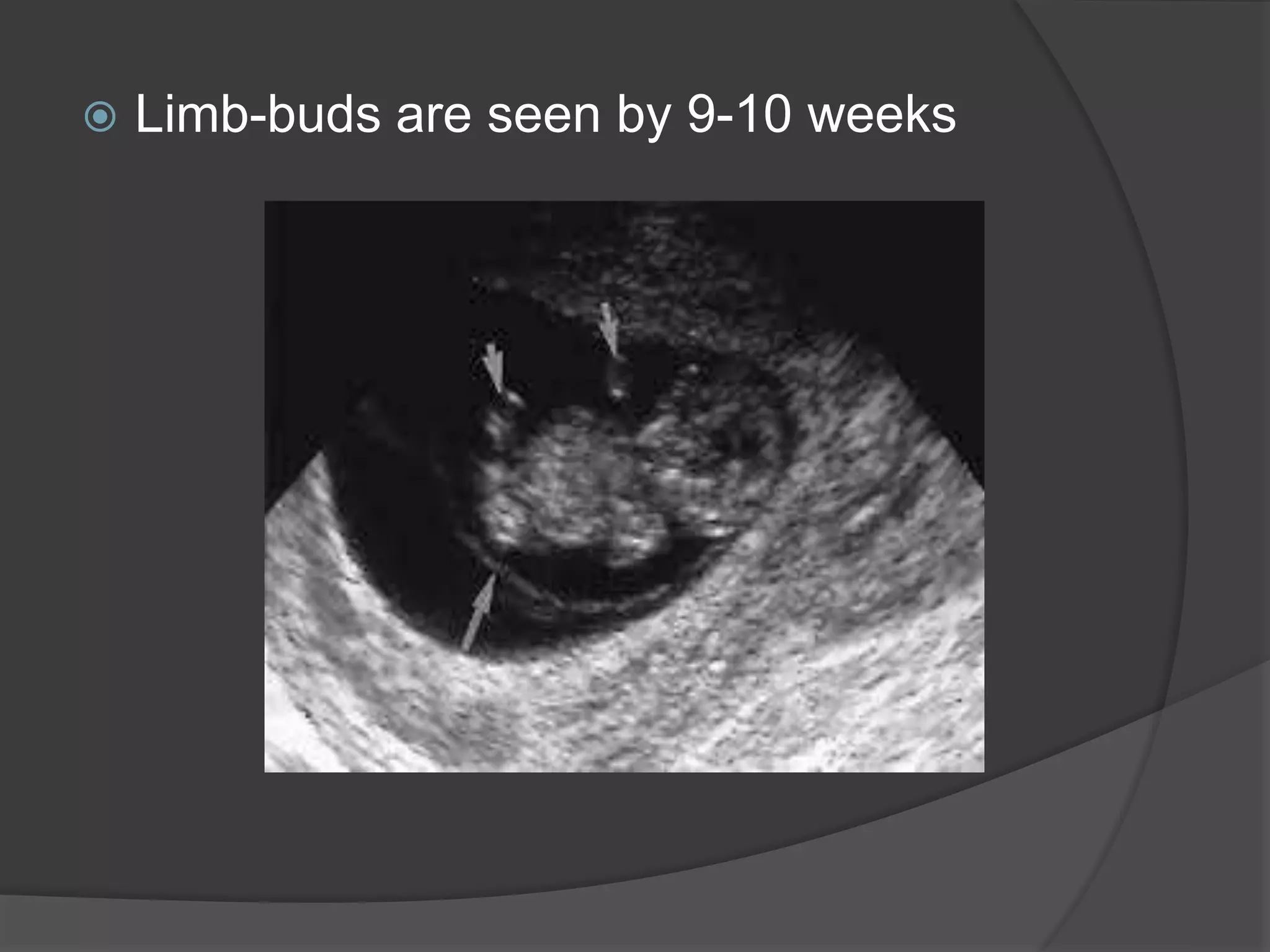 Normal early pregnancy imaging | PPT